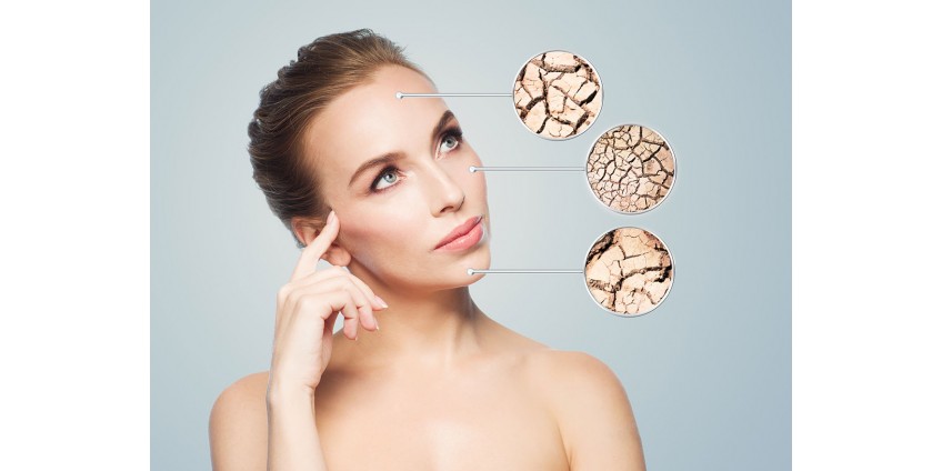 Skin dryness in fall and winter: essential care strategies for ...